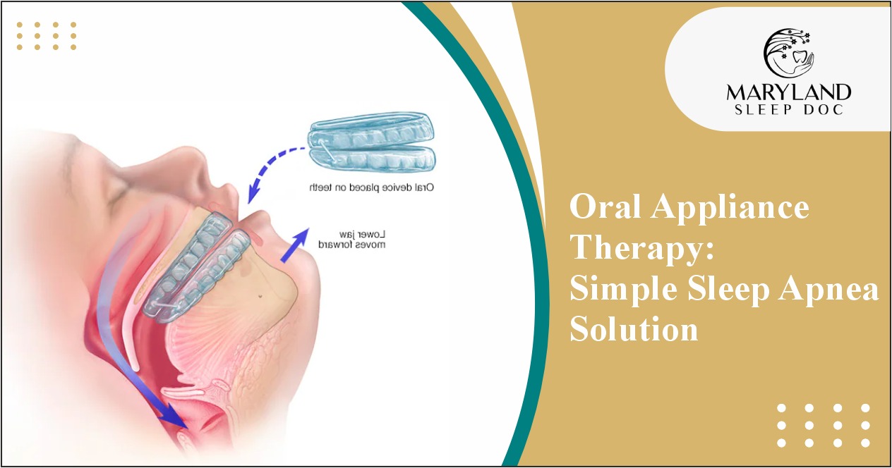 Oral Appliance Therapy for Sleep Apnea | Maryland Sleep Doc